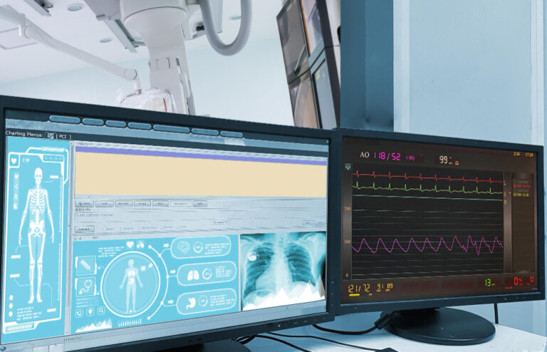 Percutaneous Coronary Intervention - Dr. Madhavan's Heart Centre